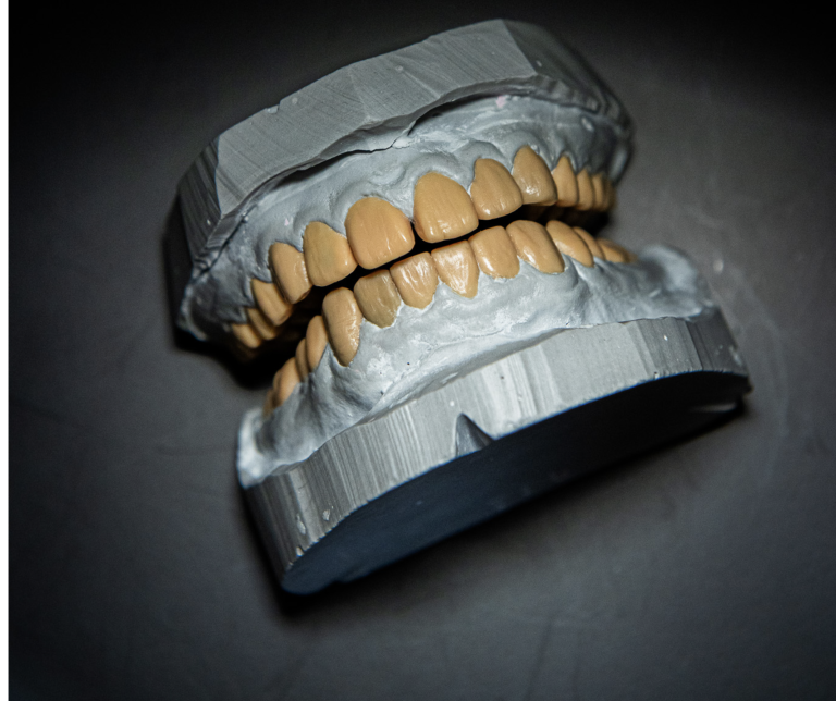 Mouthguard Color Chart – JN Dental Lab